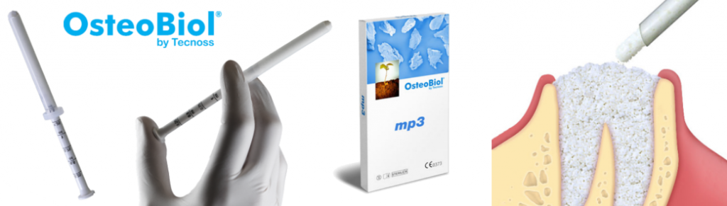 Matrice ossea OsteoBiol: per la chirurgia odontoiatrica | SP Dental