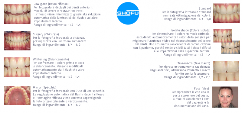 Fotocamera dentale Shofu: EyeSpecial C-II | SP Dental